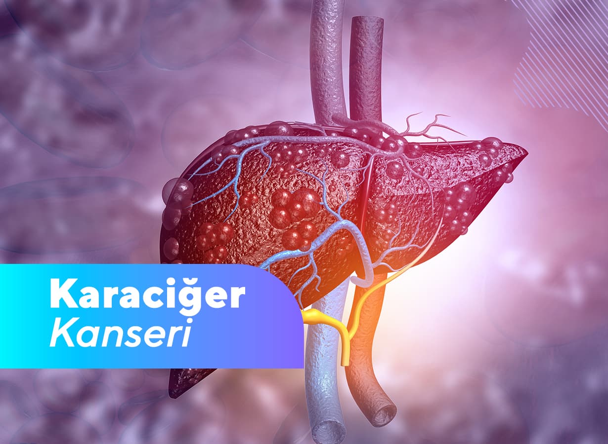 Karaciğer Kanseri Nedir? | Op.Dr Mücteba Gündüz